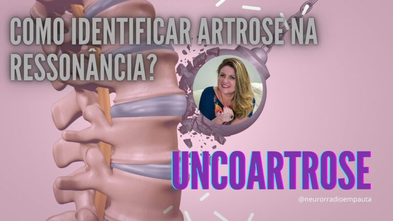 Entendendo o Significado do Discarte de Debrum Discal | Actualizado ...