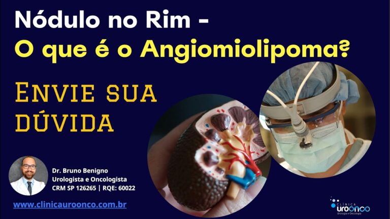 Entendendo o Nódulo de Gordura no Rim: Causas e Tratamentos ...